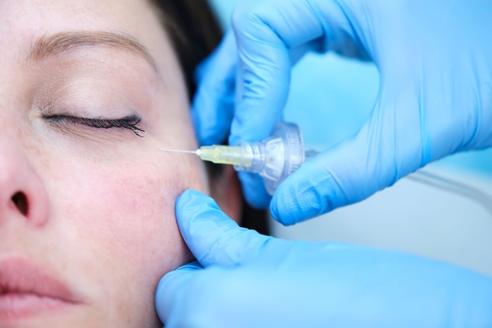 Carboxytherapy: Amazing New Technology! - Skin Care Toolbox
